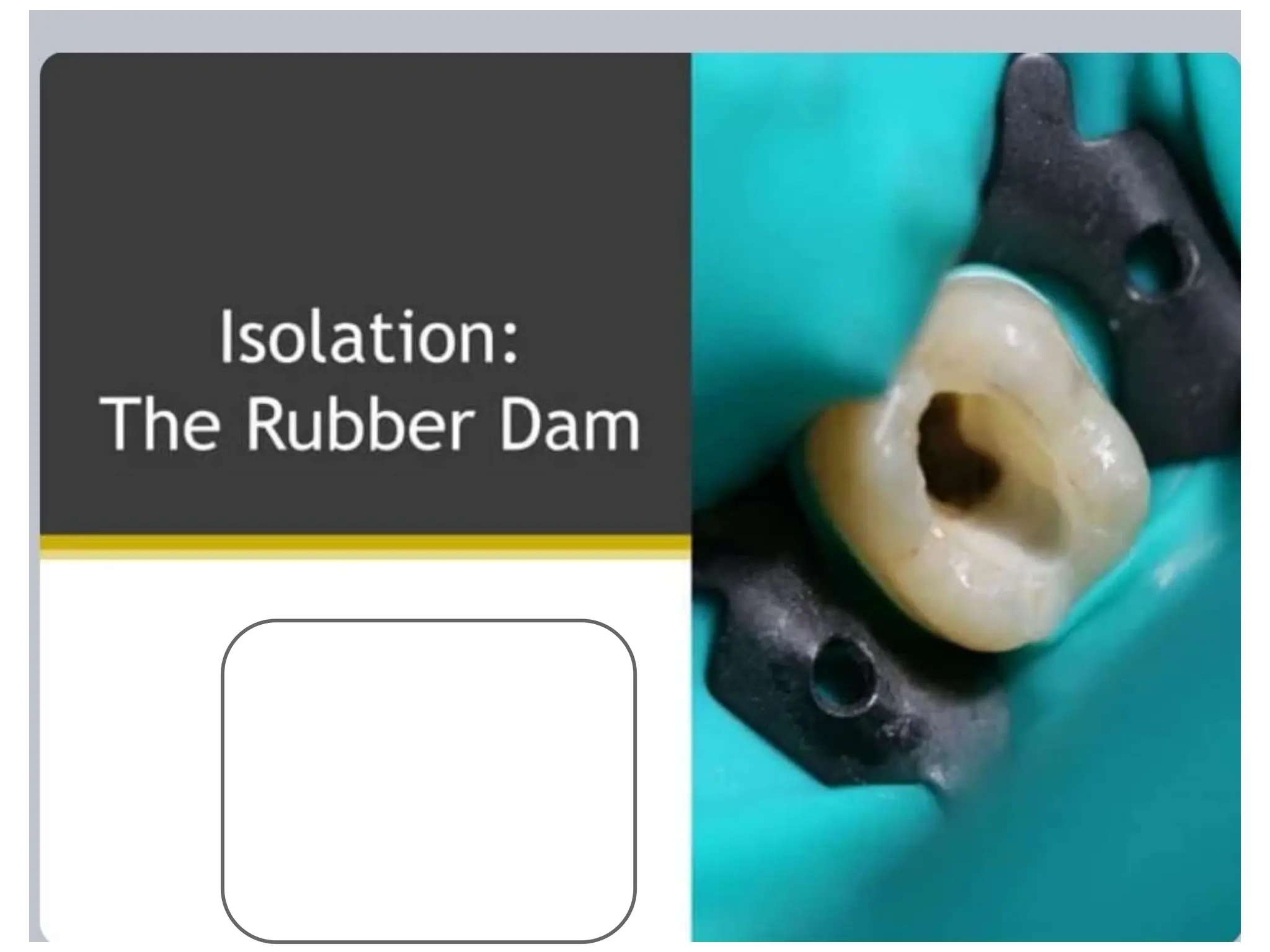 Rubber dam isolation oral cavity dr Muhammad Hasnain dental surgeon ...