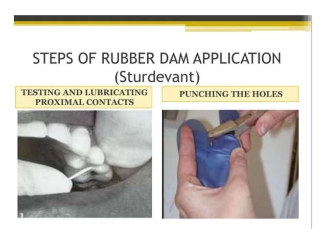 Rubber dam isolation oral cavity dr Muhammad Hasnain dental surgeon ...