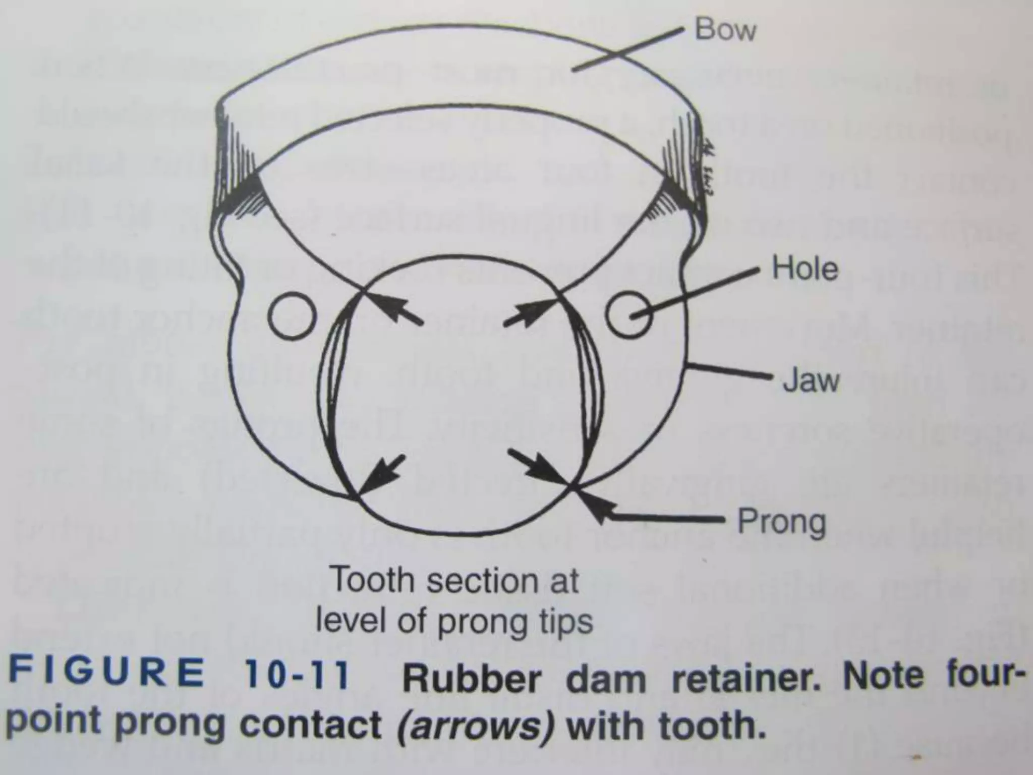 Rubber Dam - Dentistry | PPSX