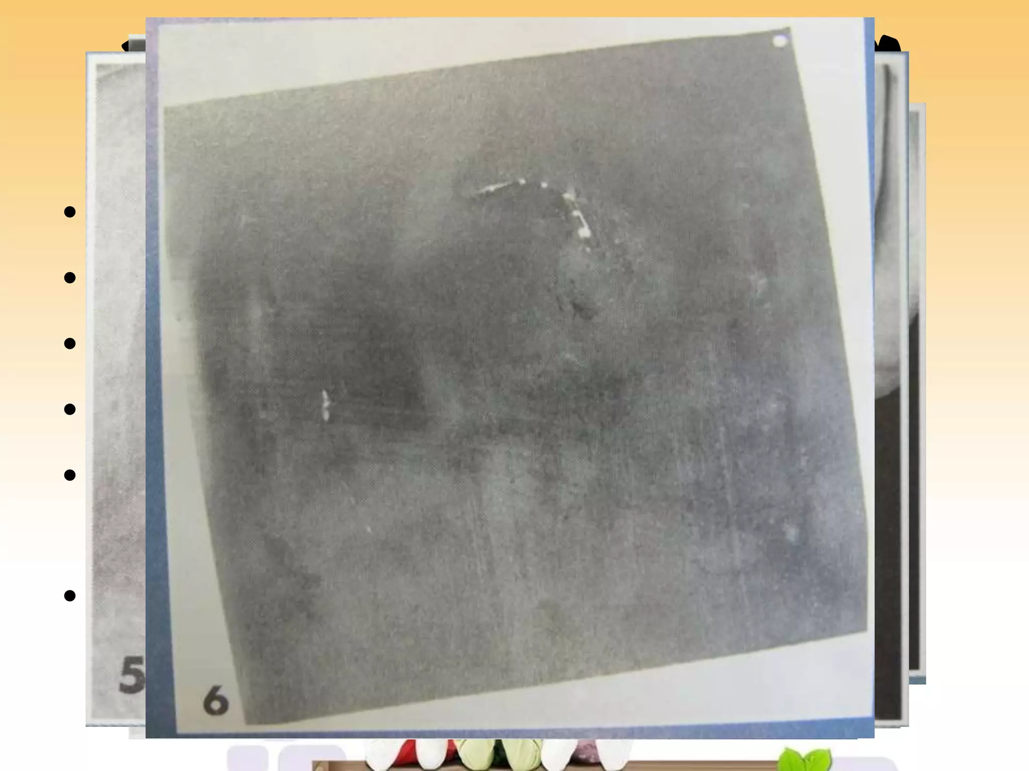 Rubber Dam - Dentistry | PPSX