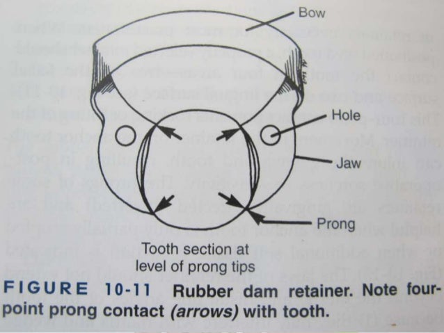 Rubber Dam - Dentistry