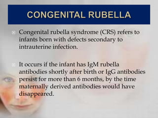 Rubella | PPTX