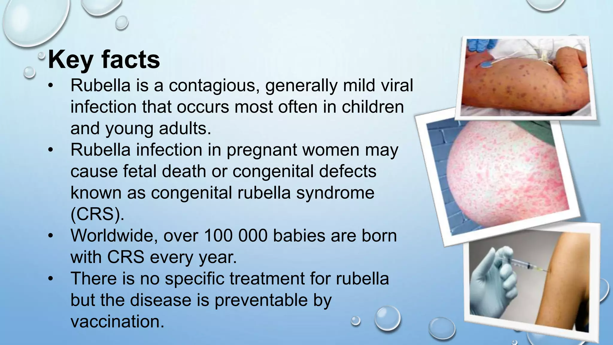 Rubella | PPTX