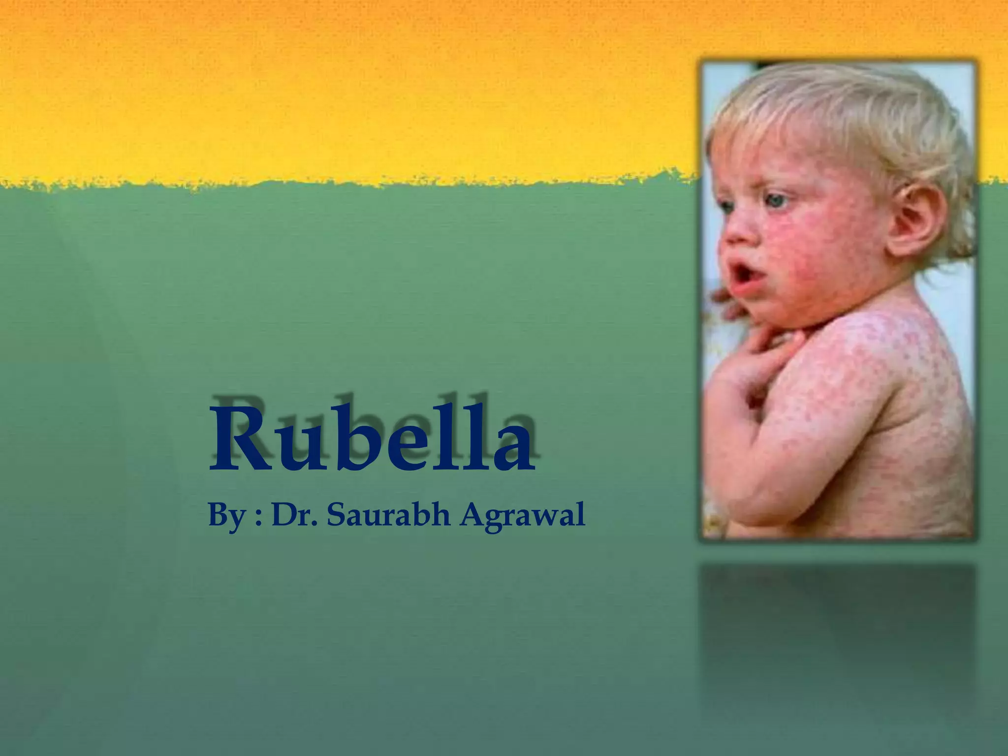 Rubella | PPTX