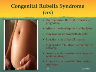 Rubella | PPTX