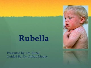 Rubella (Seminar) | PPTX