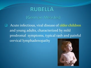 Rubella | PPTX