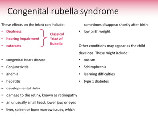 Congenital Rubella Syndrome Adult
