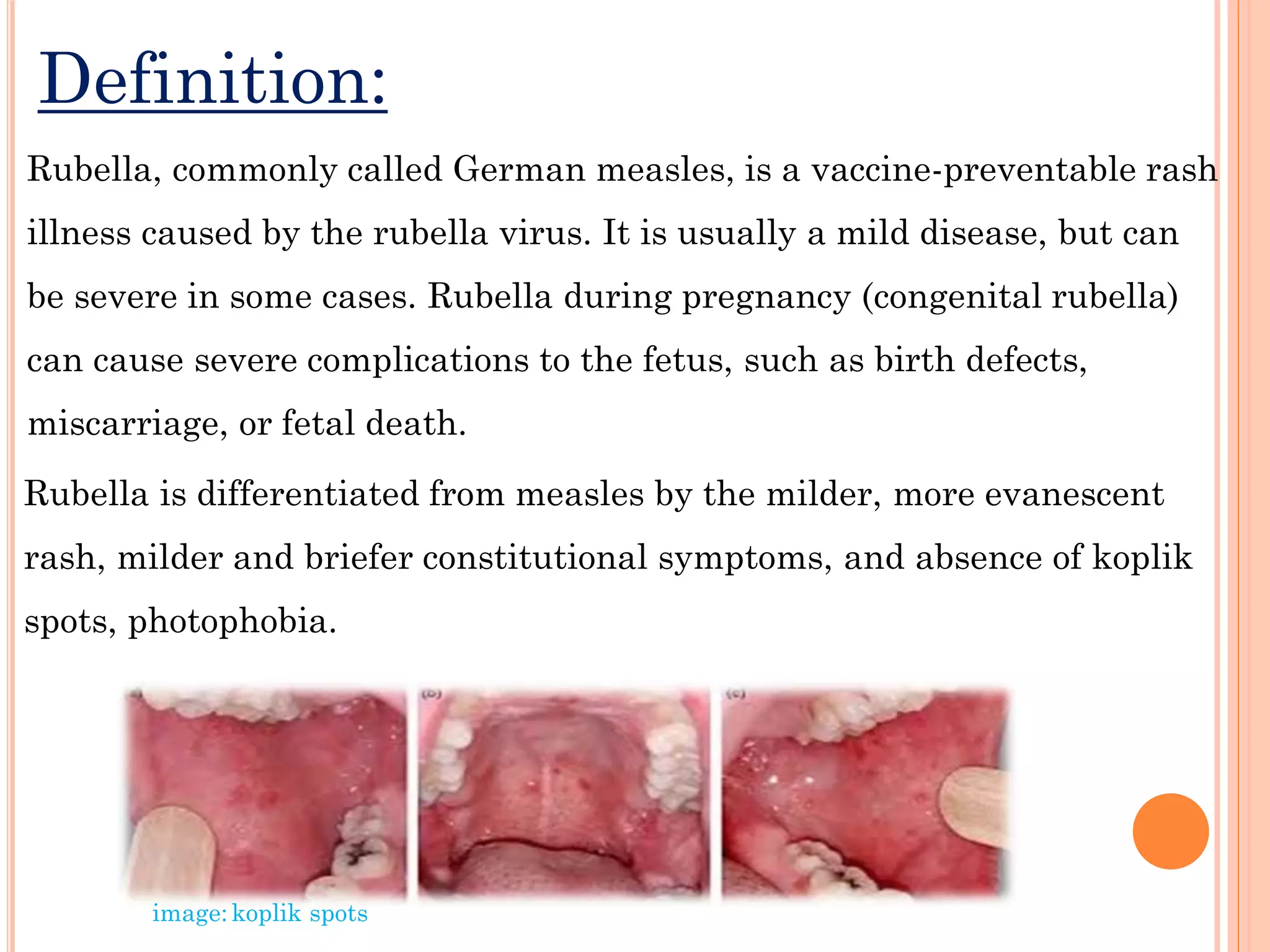 rubella.pdf