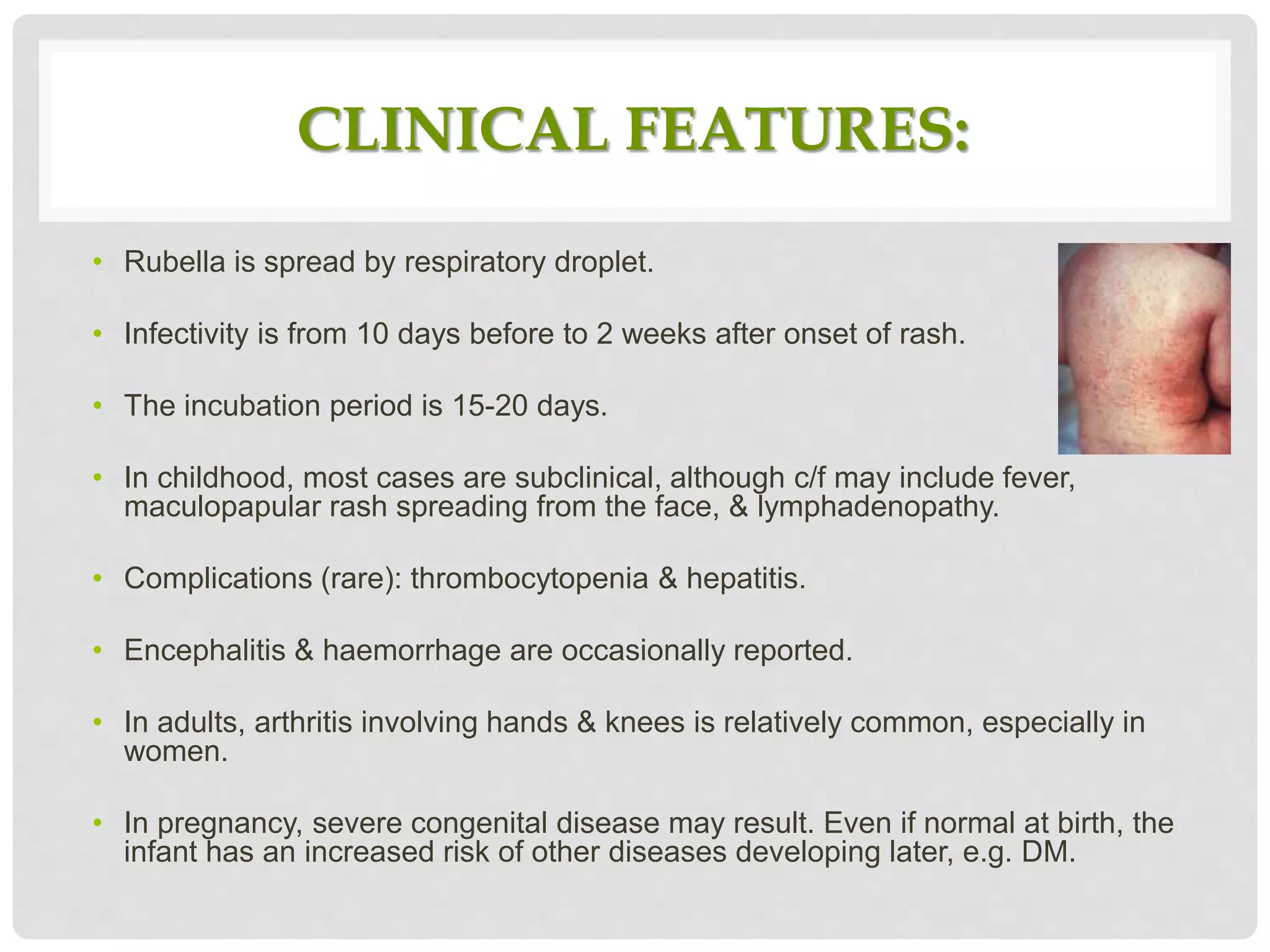 Rubella (german measles) | PPTX
