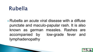 Rubella in english | PPTX