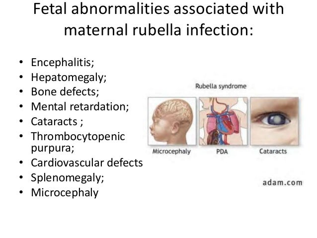 Rubella infection
