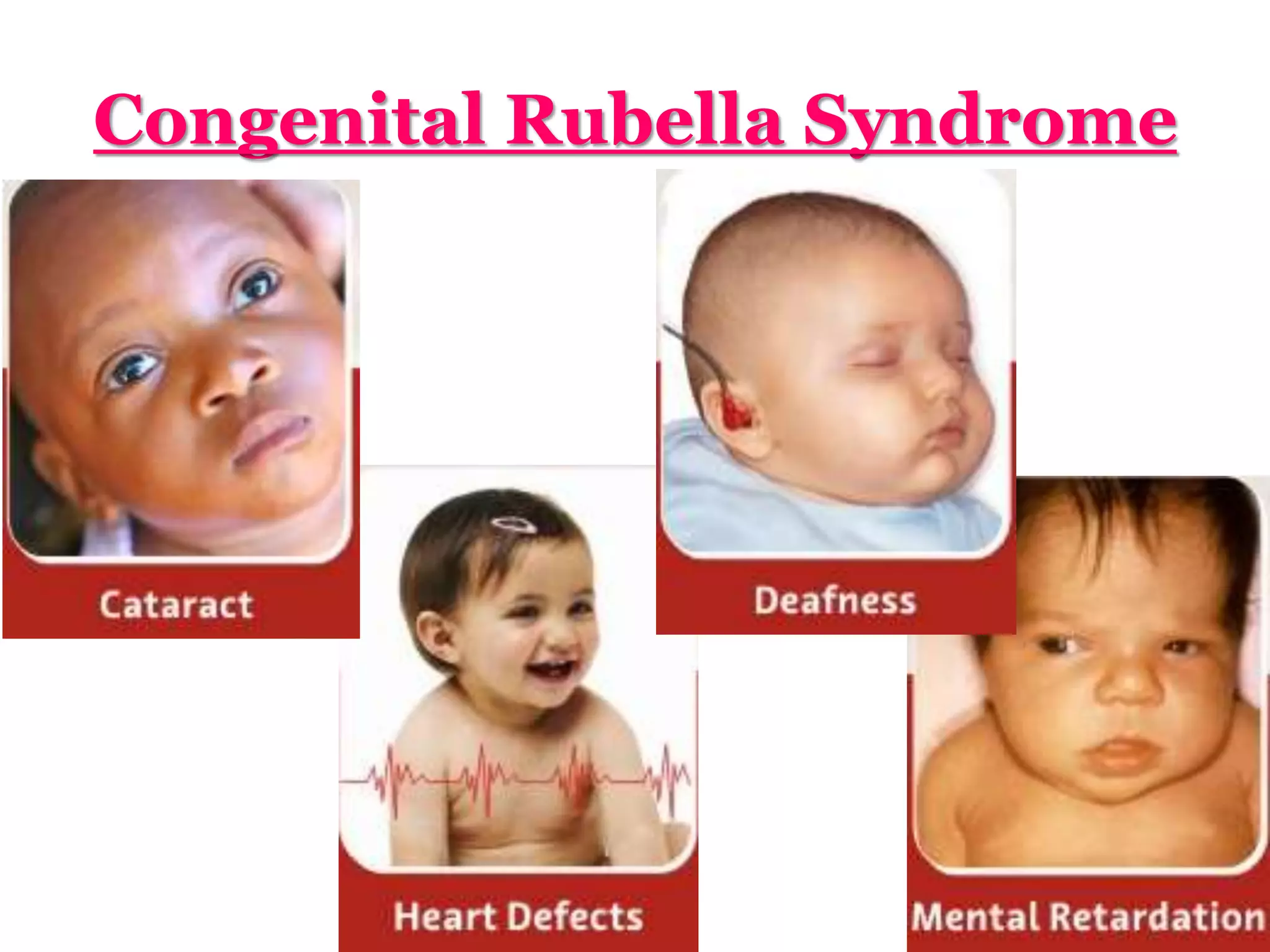 Rubella new general.pptx