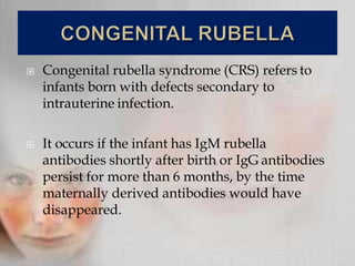 Rubella slide | PPTX