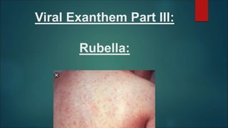 Rubella virus ppt | PPT