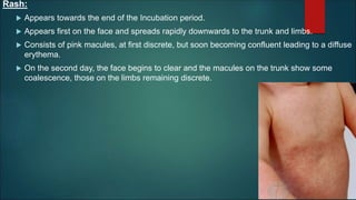 Rubella virus ppt | PPT