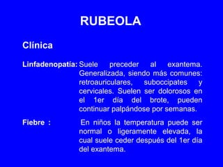 Rubeola | PPT