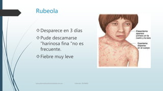 Rubeola | PPTX