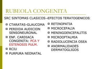 Rubeola congenita | PPT