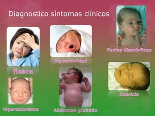 Rubeola congenita caso clinico | PPTX