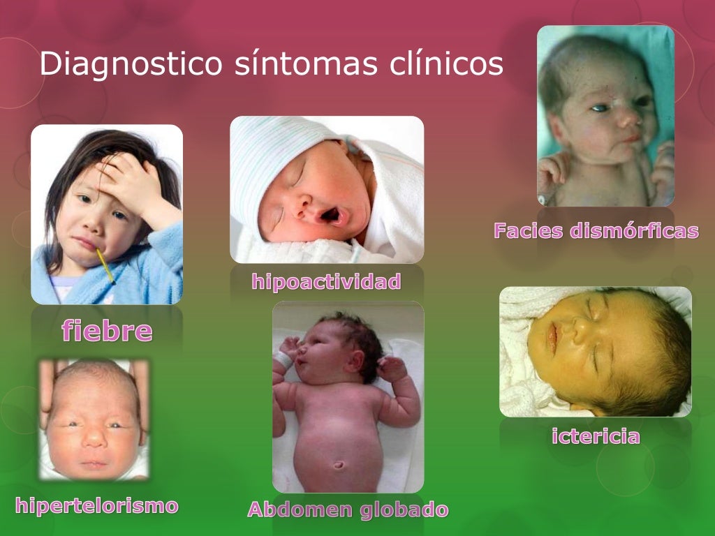 Rubeola congenita caso clinico