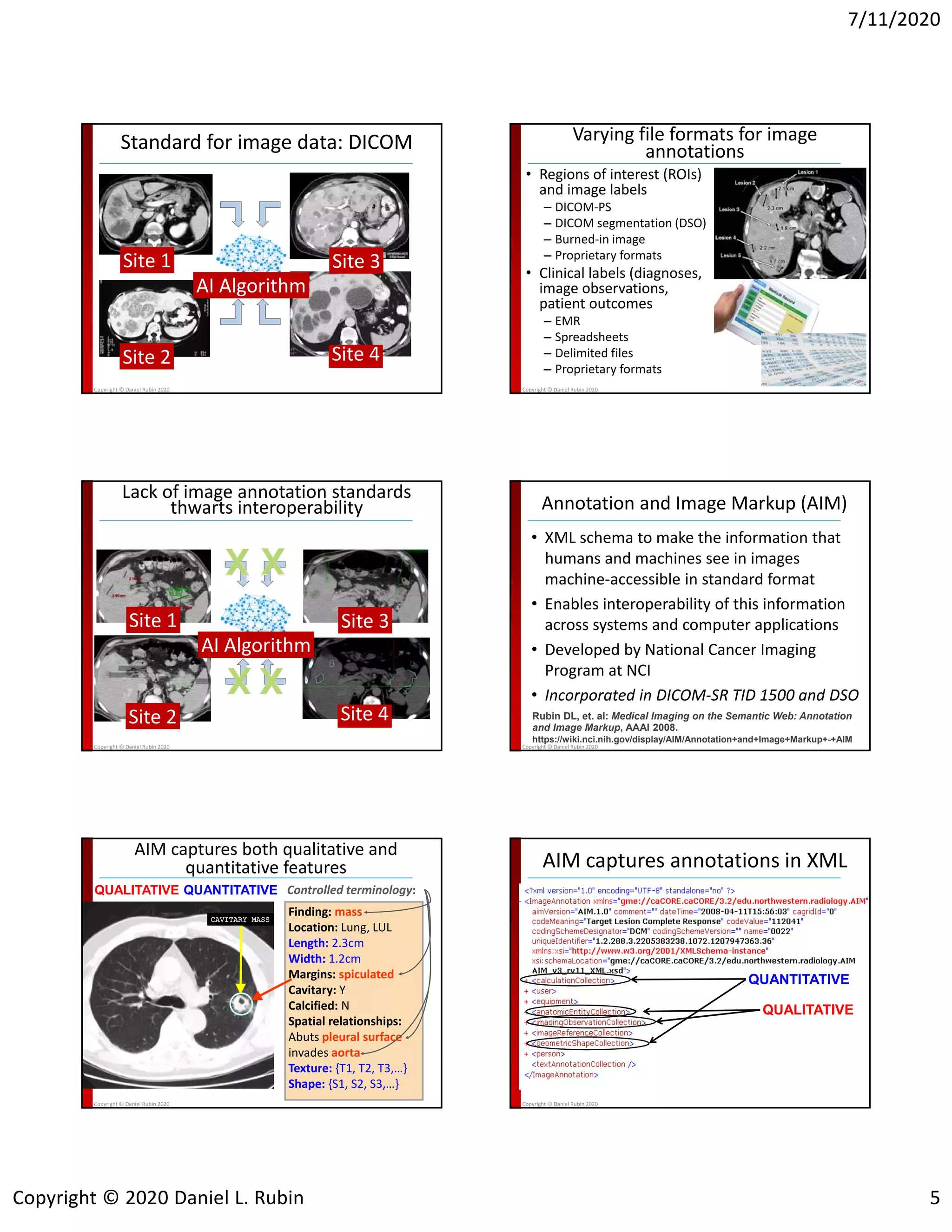 Making Radiology AI Models more robust: Federated Learning and other ...
