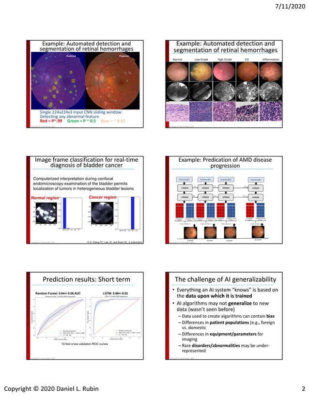 Making Radiology AI Models more robust: Federated Learning and other ...