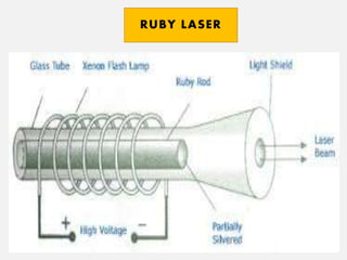 Ruby laser | PPTX