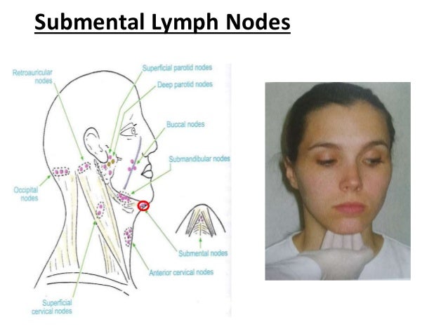 Enlarged Lymph Node Under Chin