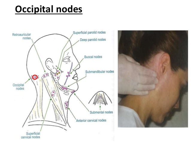 Occipital Lymph Nodes Matvikol