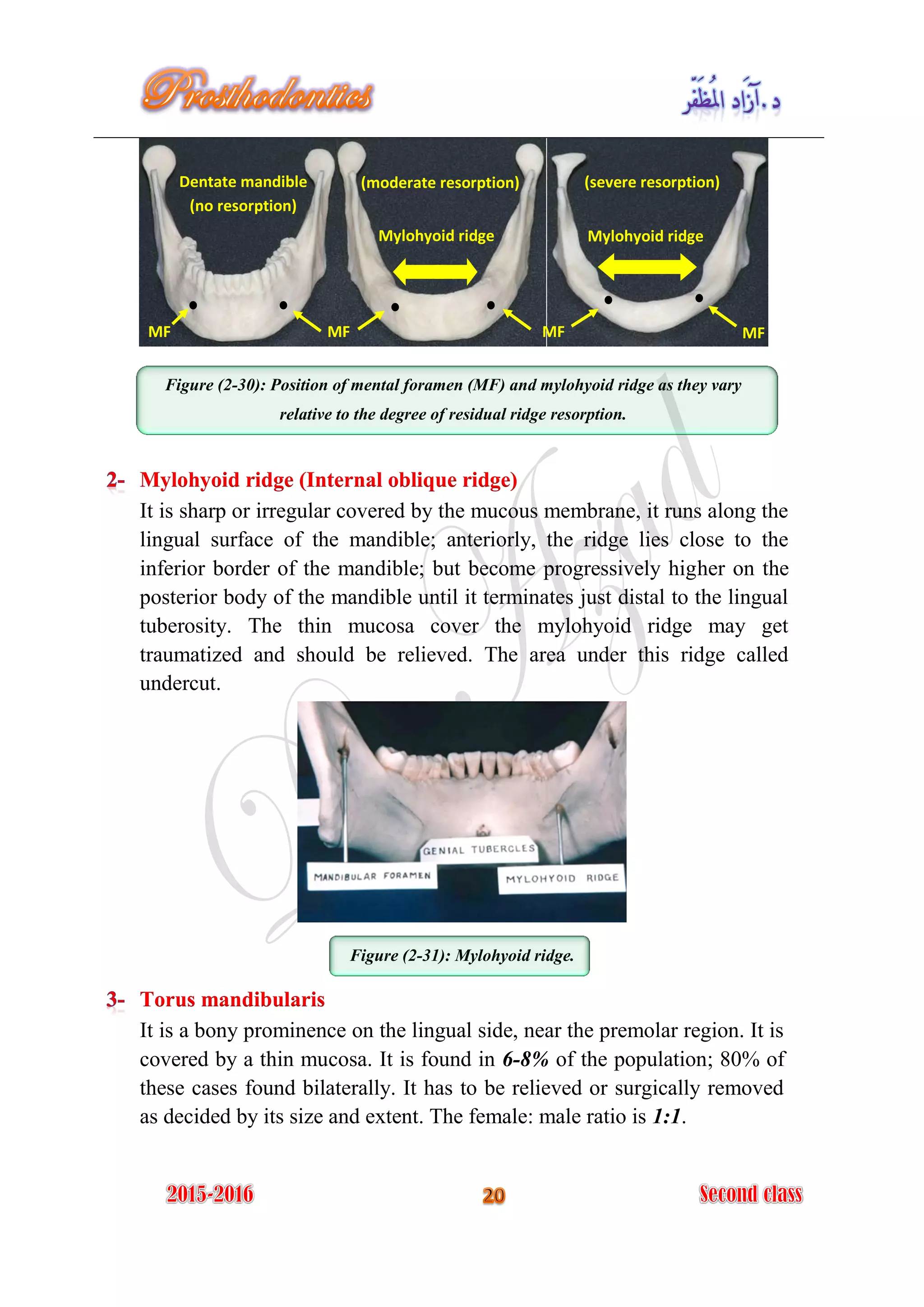 Complete denture prosthodontics 2016 | PDF