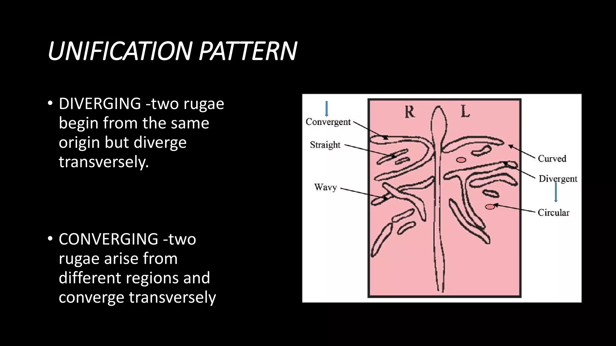 Rugae fabrication | PPTX