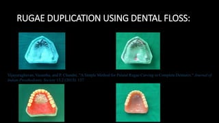 Rugae fabrication | PPTX