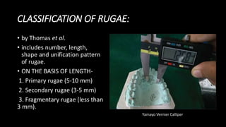 Rugae fabrication | PPTX