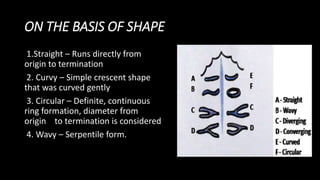 Rugae fabrication | PPTX