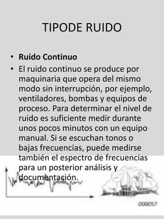 Ruido | PPTX