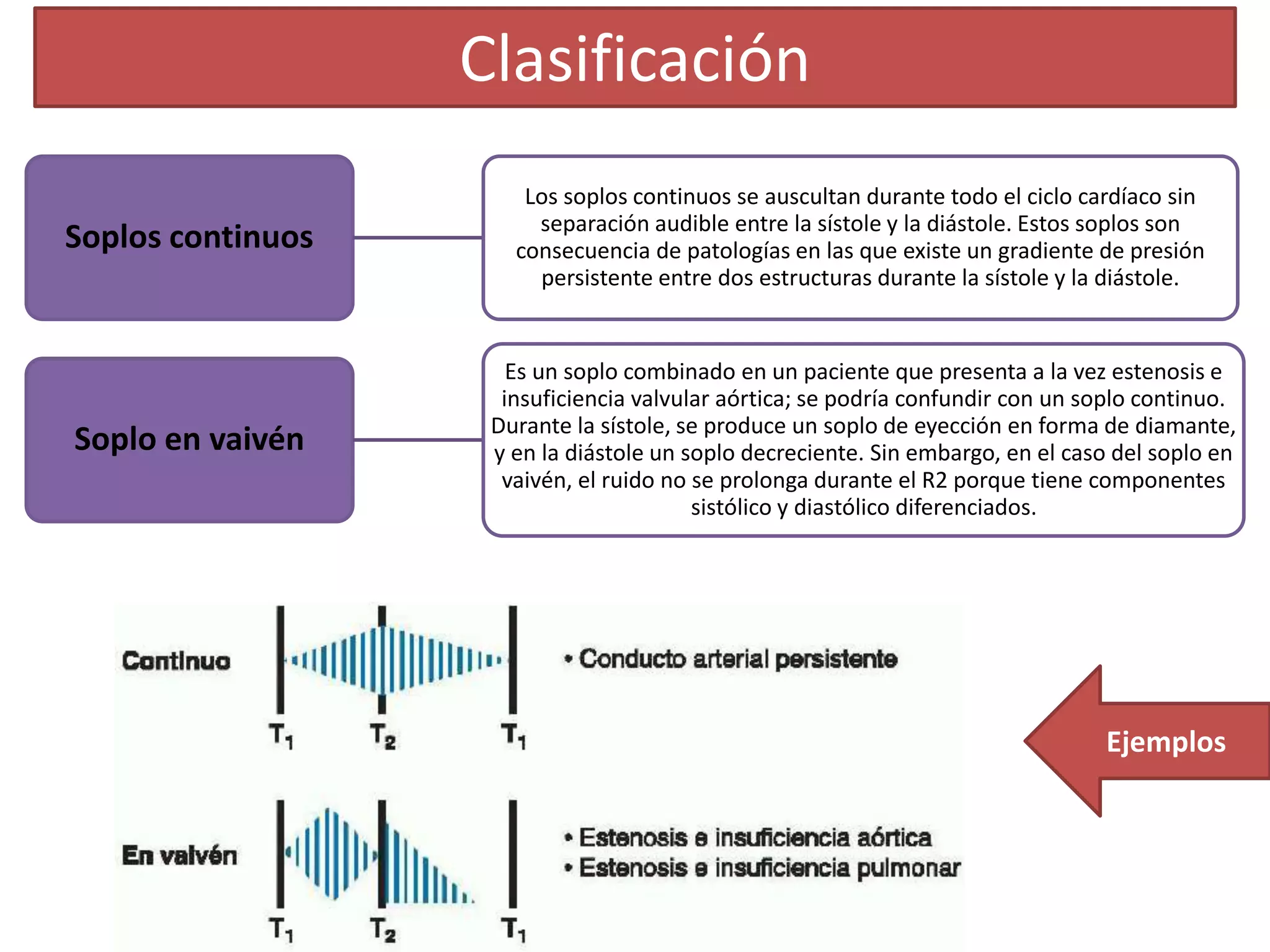 Ruidos cardíacos | PPT