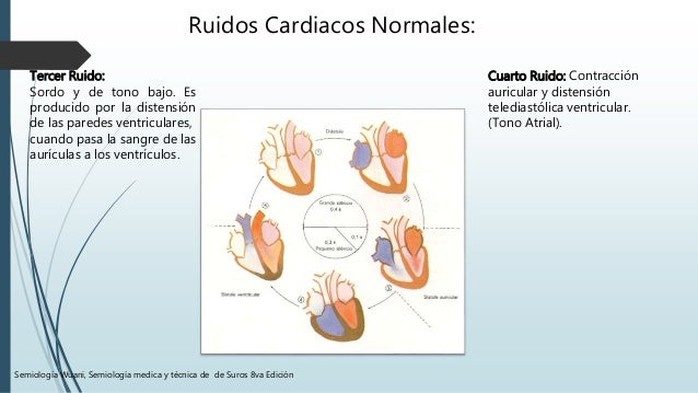 Ruidos cardiacos y soplos