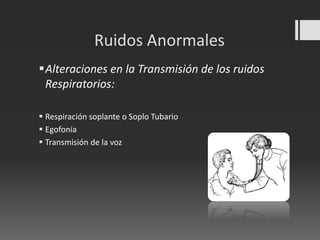 Ruidos pulmonares | PPTX