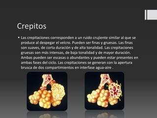 Ruidos pulmonares | PPTX