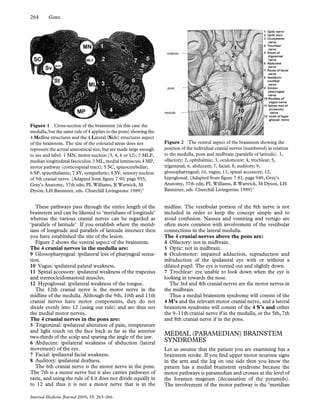 Tashia Seeba Neurology Exam - Rule of 4 Brainstem | PDF | Brain and Nervous System Disorders ...