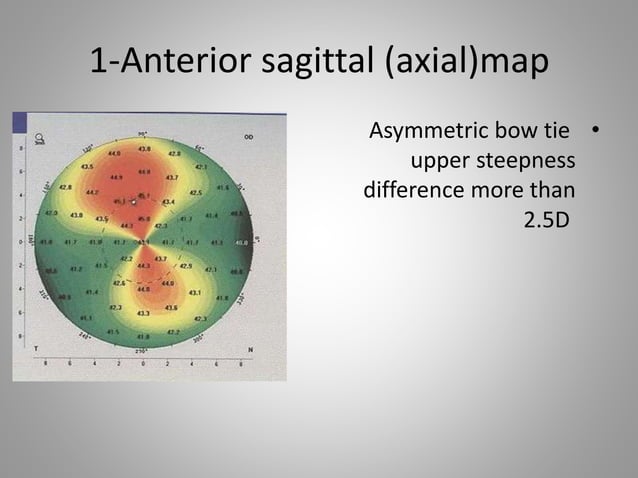 Rules in refractive surgery | PPTX | Eye and Vision Conditions ...