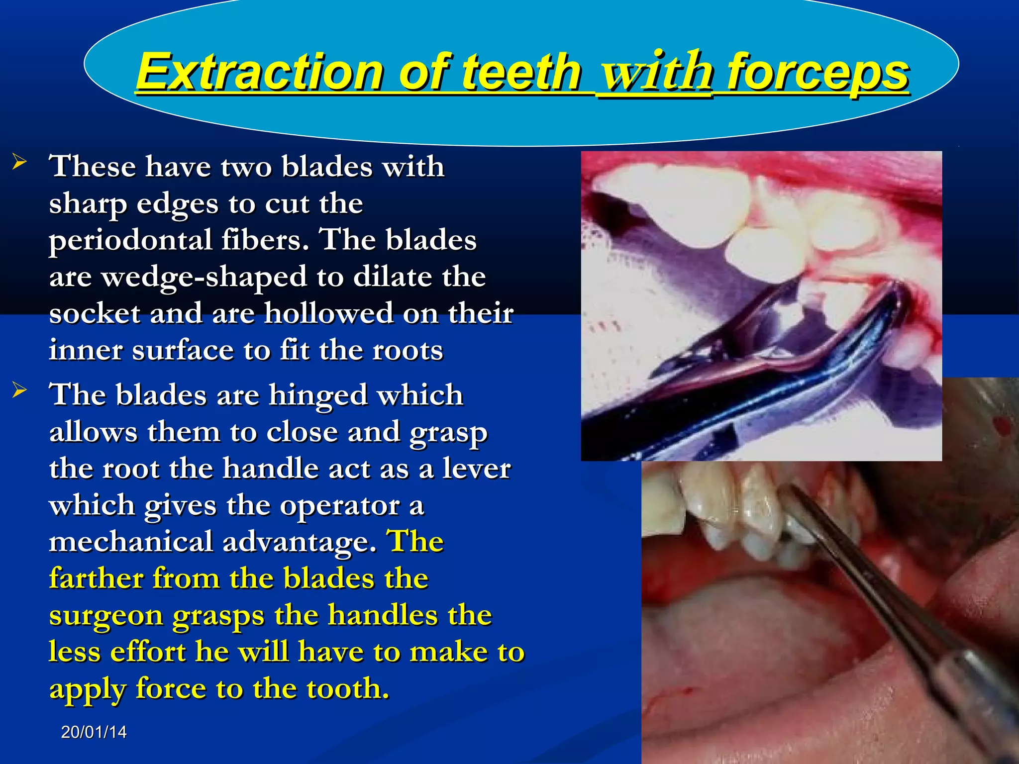 Rules of using dental forceps & elevator | PPT