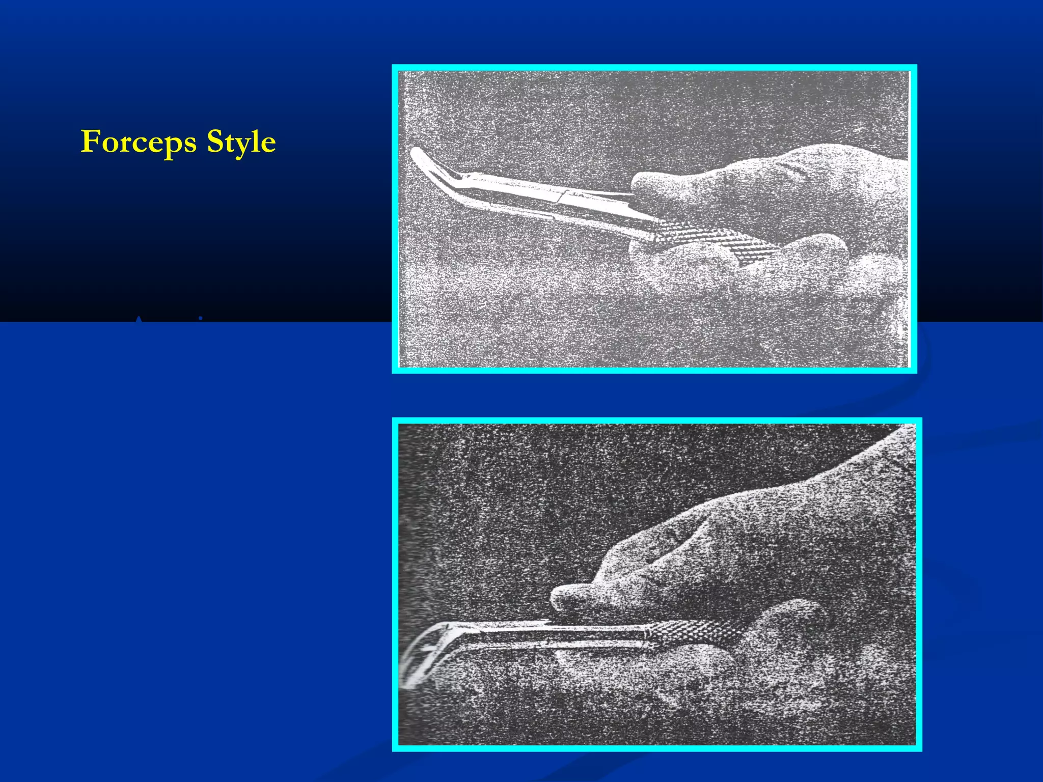 Rules of using dental forceps & elevator | PPT