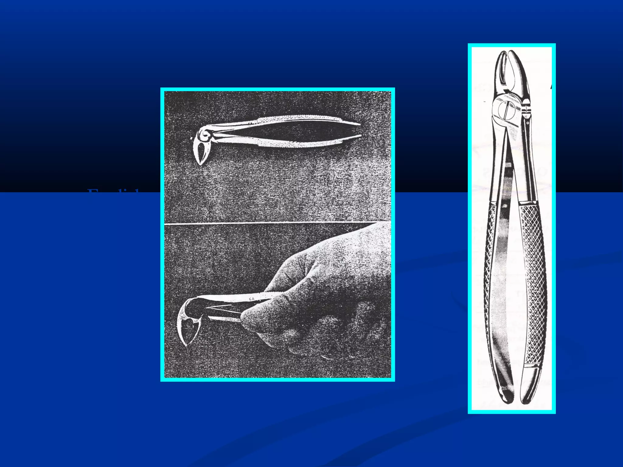 Rules of using dental forceps & elevator | PPT