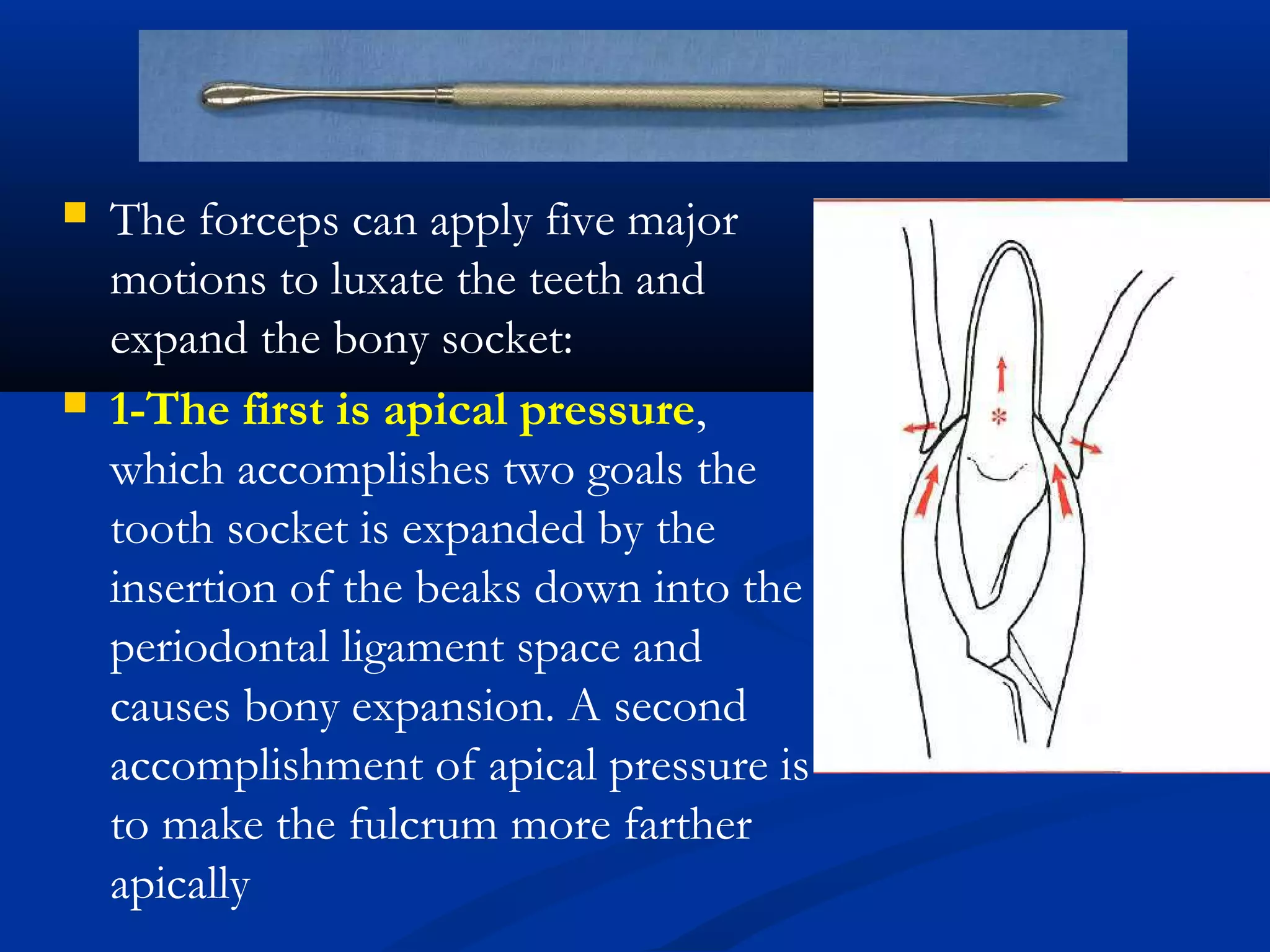 Rules of using dental forceps & elevator | PPT