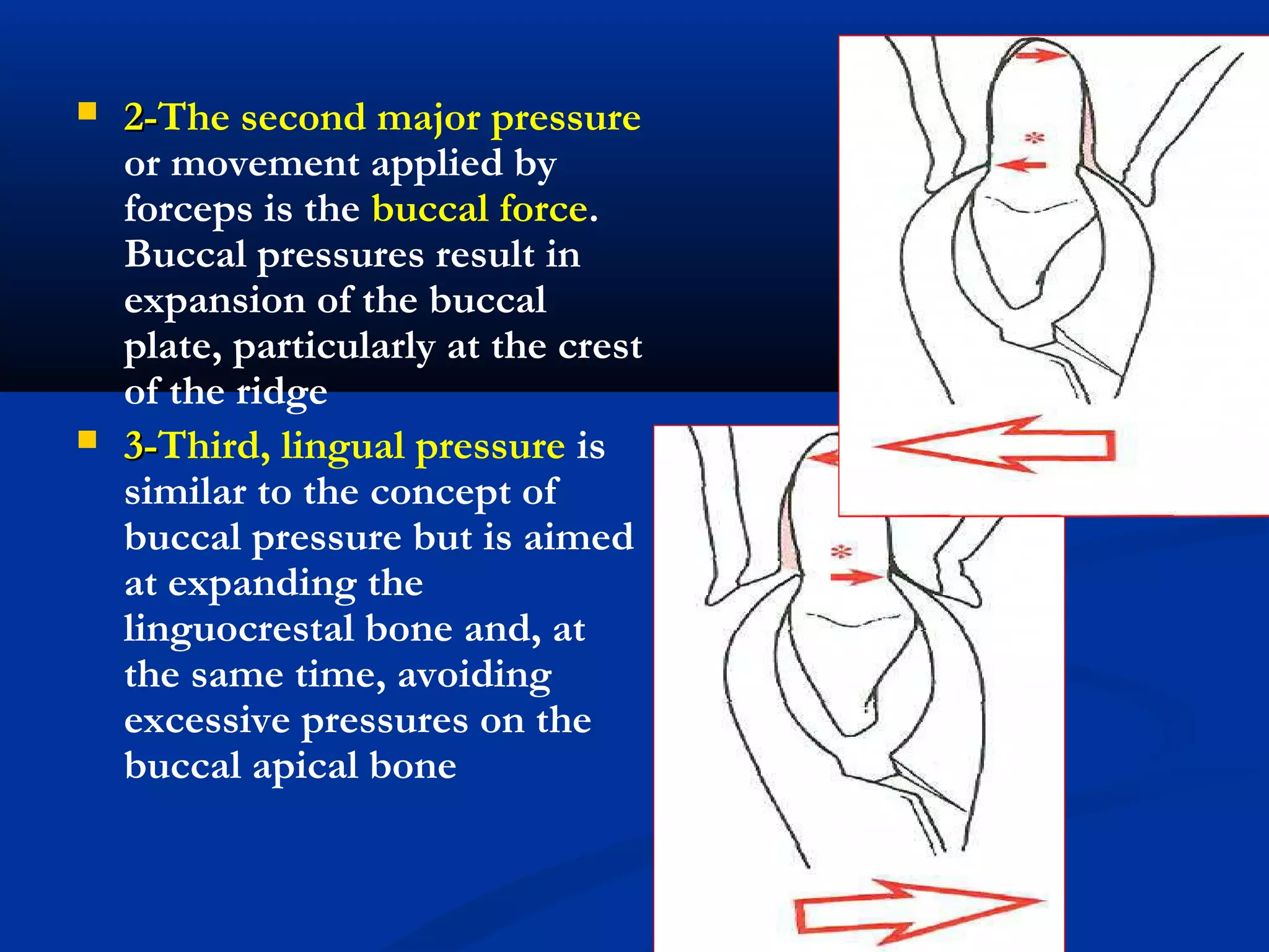 Rules of using dental forceps & elevator | PPT