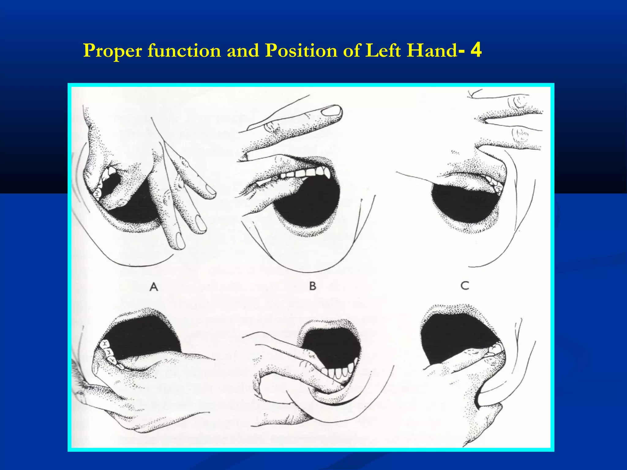 Rules of using dental forceps & elevator | PPT