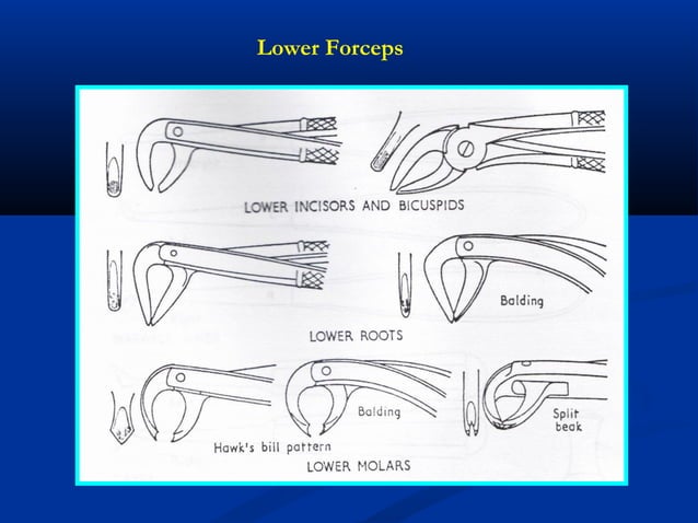 Rules of using dental forceps & elevator | PPT | Dental Health ...