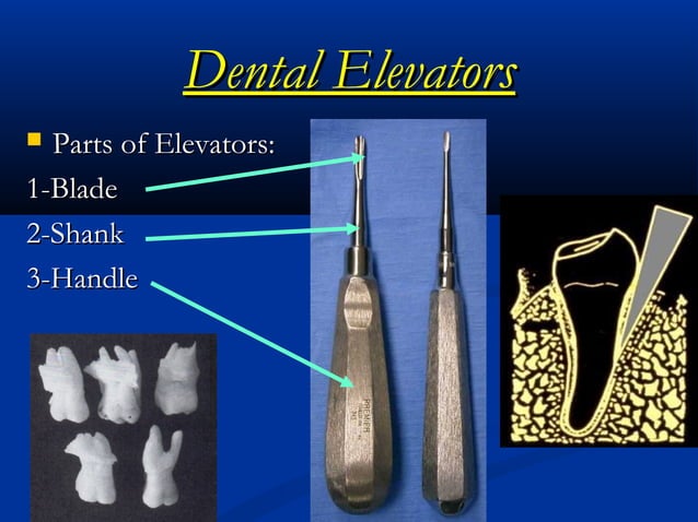 Rules of using dental forceps & elevator | PPT | Dental Health | Diseases and Conditions